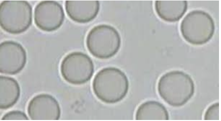 Live Blood and Cancer - Renaissance Health Centre